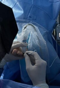 Síndrome de BAXTER o Neuropatía de la Rama de BAXTER – Clínica Ferrer Salud