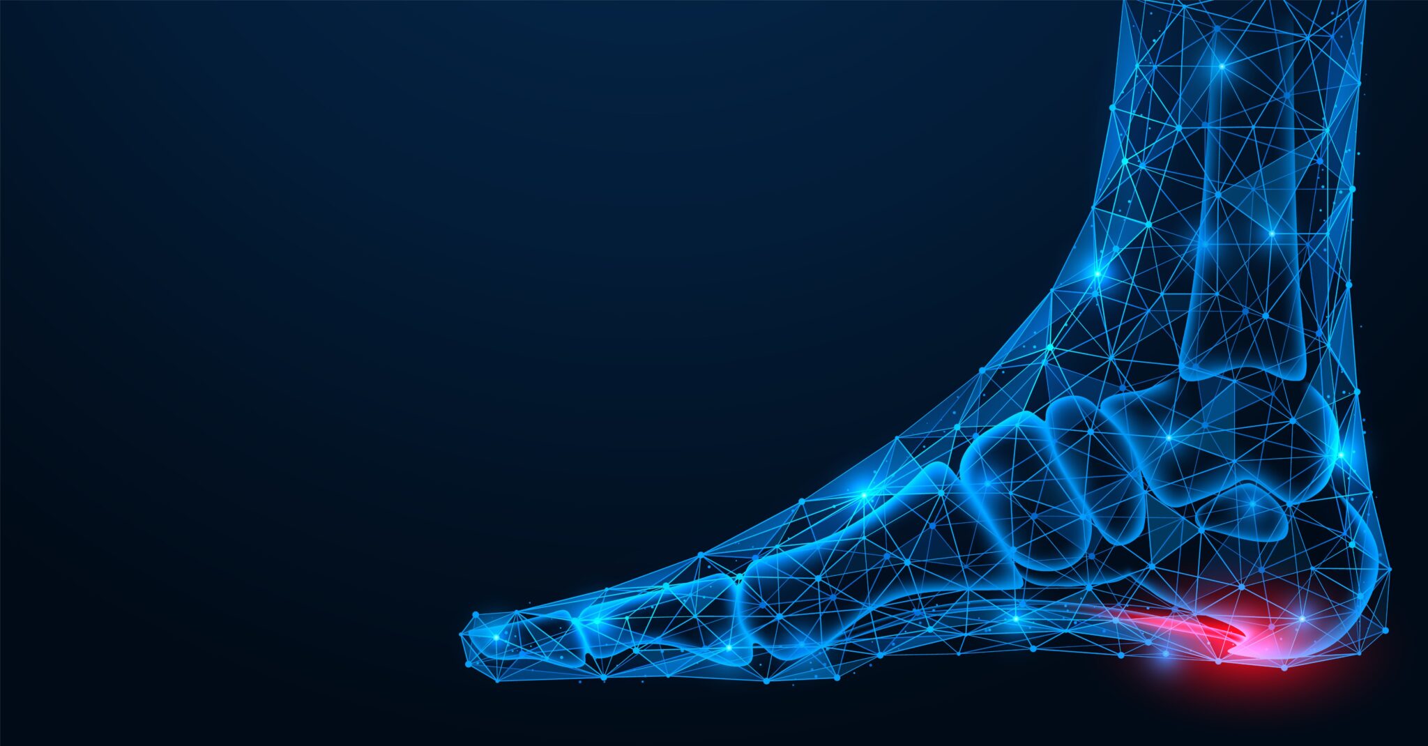 Fascitis plantar/Espolón Calcáneo – Clínica Ferrer Salud